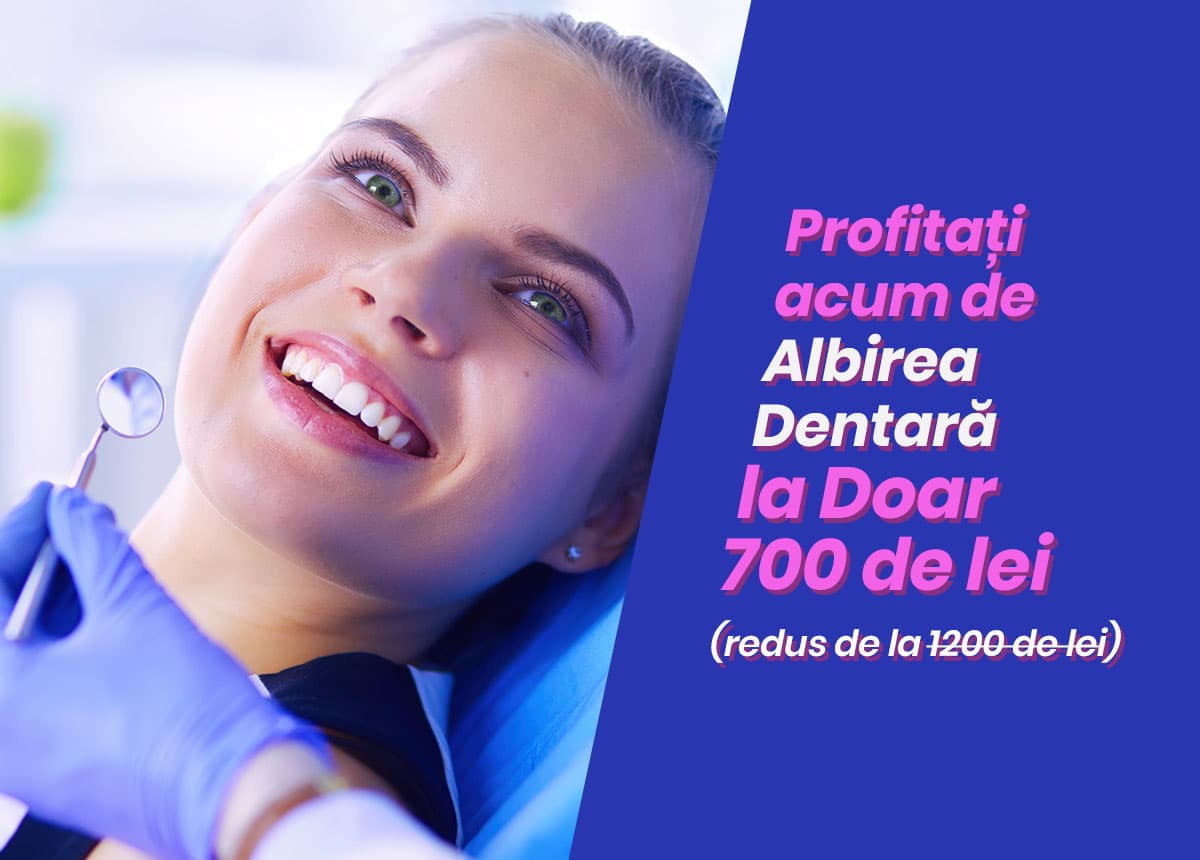 Albire dentara pret si beneficii